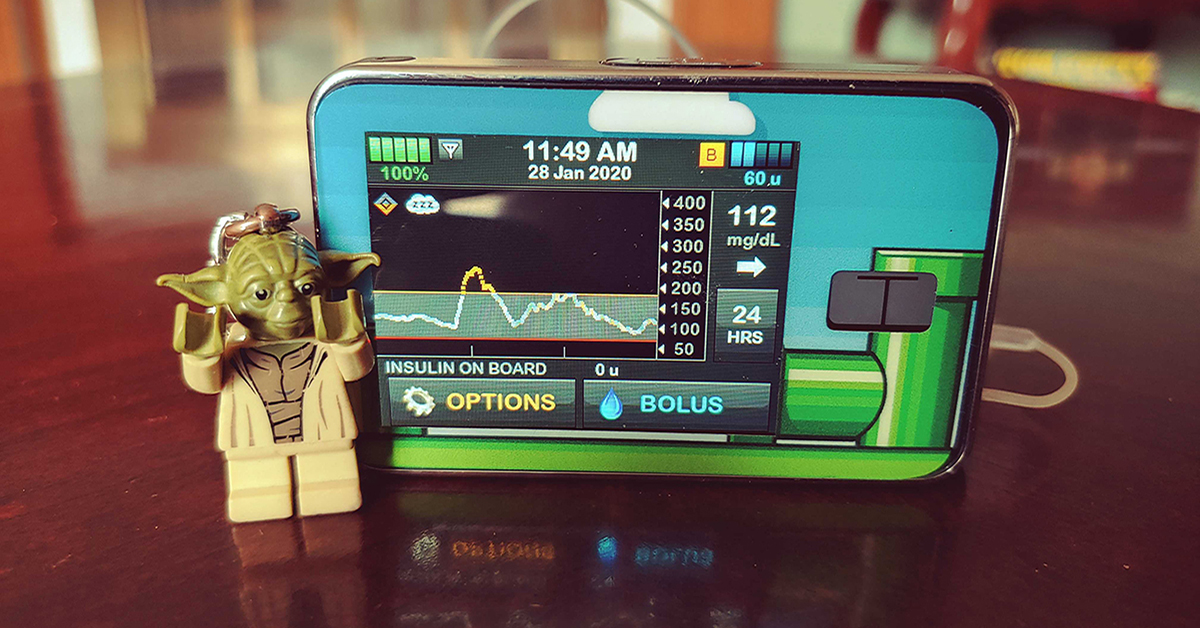 Product Review: Tandem Diabetes Control-IQ - The Official HoPE Blog